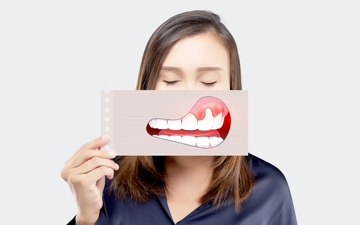 Gum inflammation—causes, symptoms, and stages - Complete Dental Works